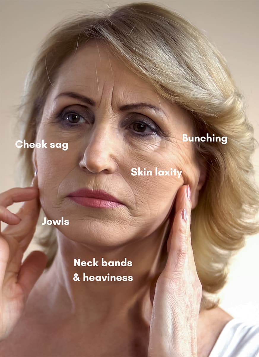 SMAS vs. Deep Plane Facelift: Which Technique Fits You?