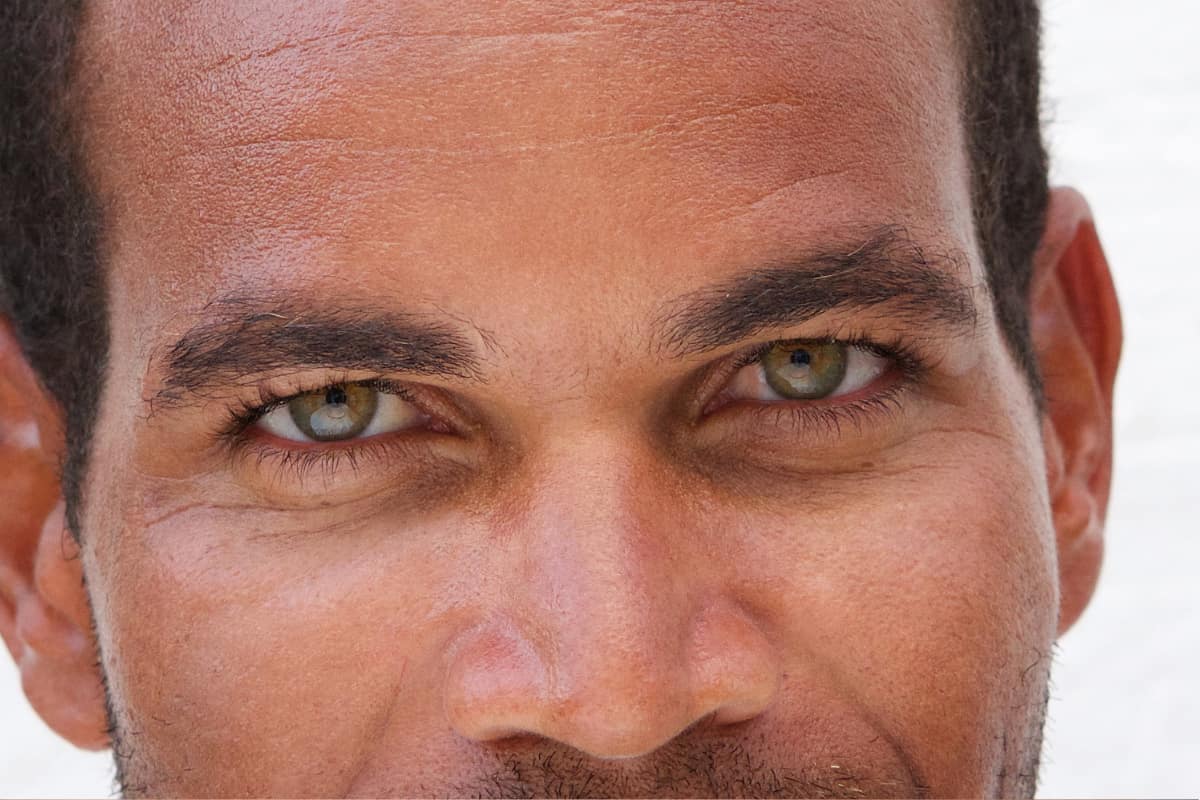 Eyelid Surgery for Men: Natural, Sharper Eye Results